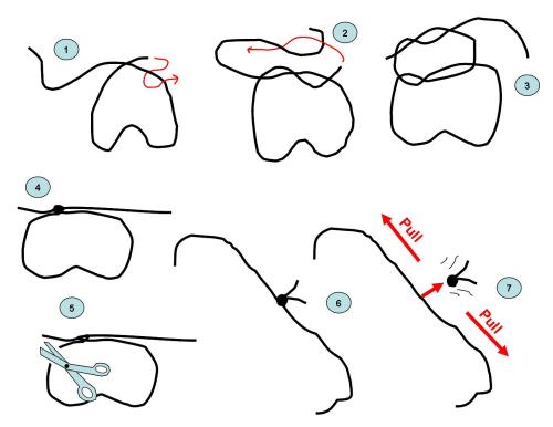 Knot a Problem | Teach Them